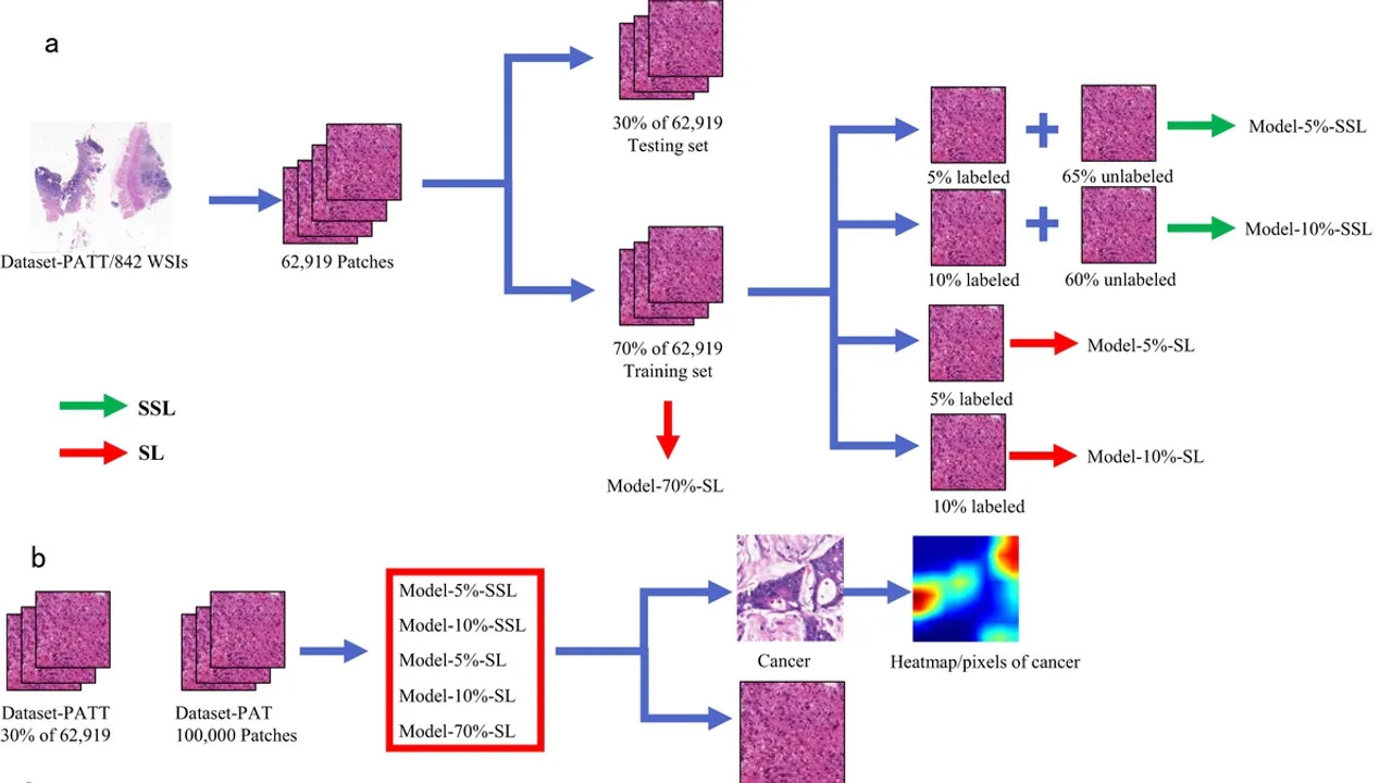 Revolutionizing Colorectal Cancer Diagnosis: A Deep Dive into AI's ...