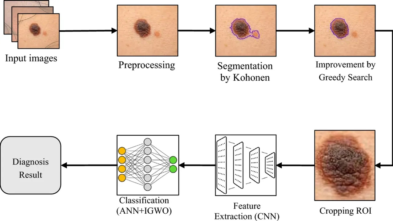Revolutionizing Skin Cancer Detection With Convolution Neural Networks